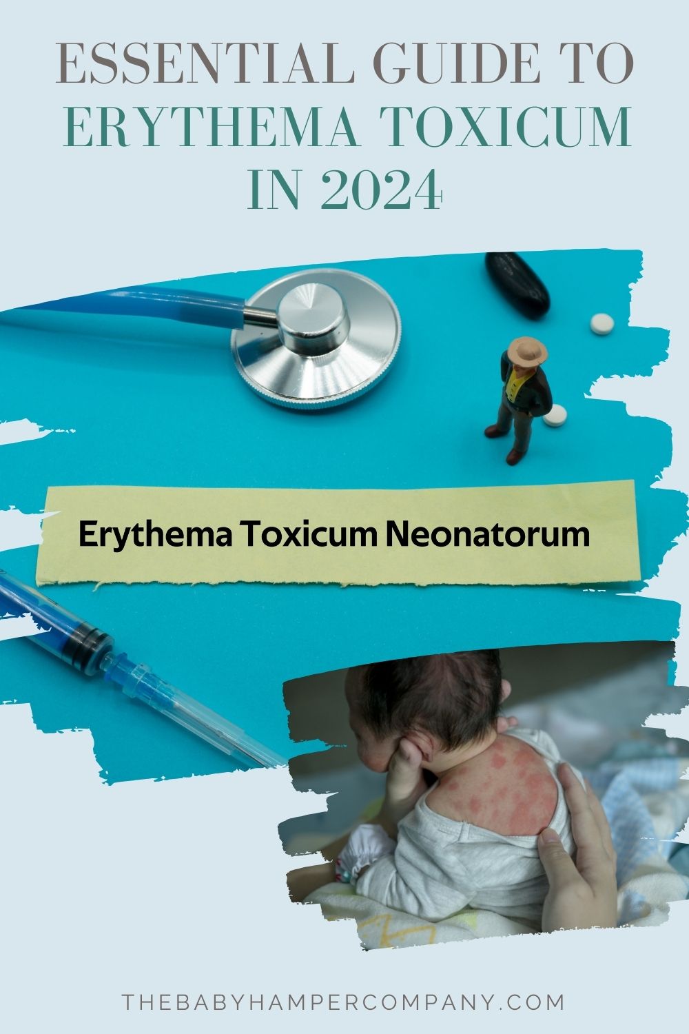 Essential Guide to Erythema Toxicum in 2024